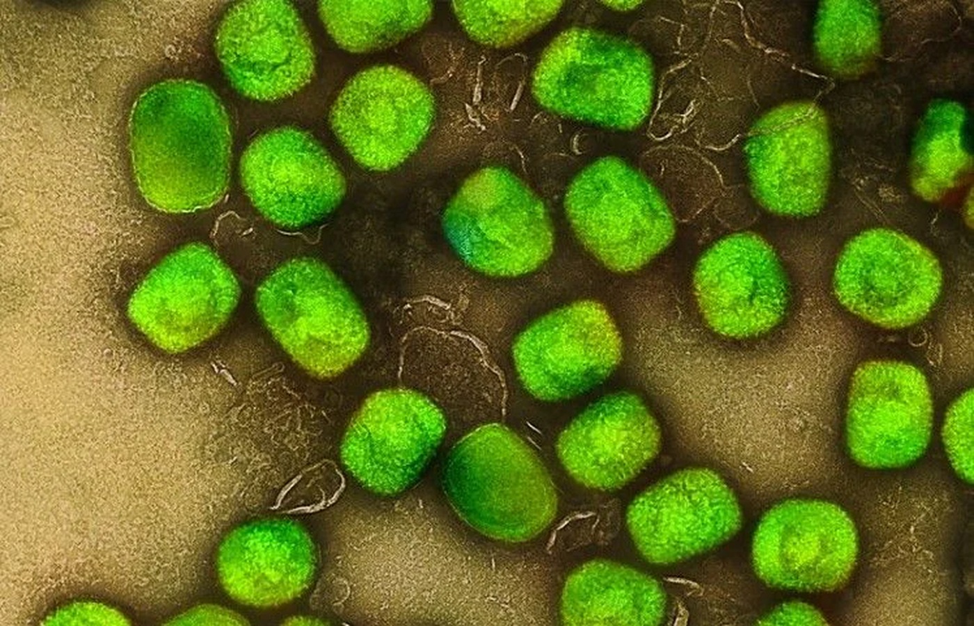 WHO maintains mpox alert amid West Africa surge | ABS-CBN News