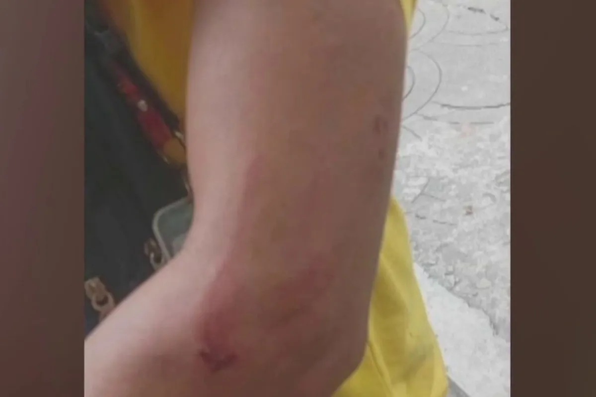 TV PATROL: Pamilya ng PWD nagdemanda matapos mabugbog, gamitan ng taser ...