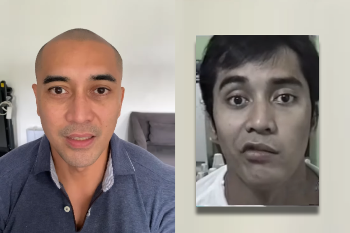Gerard Pizarras shares battle with Bell’s Palsy for the second time ...