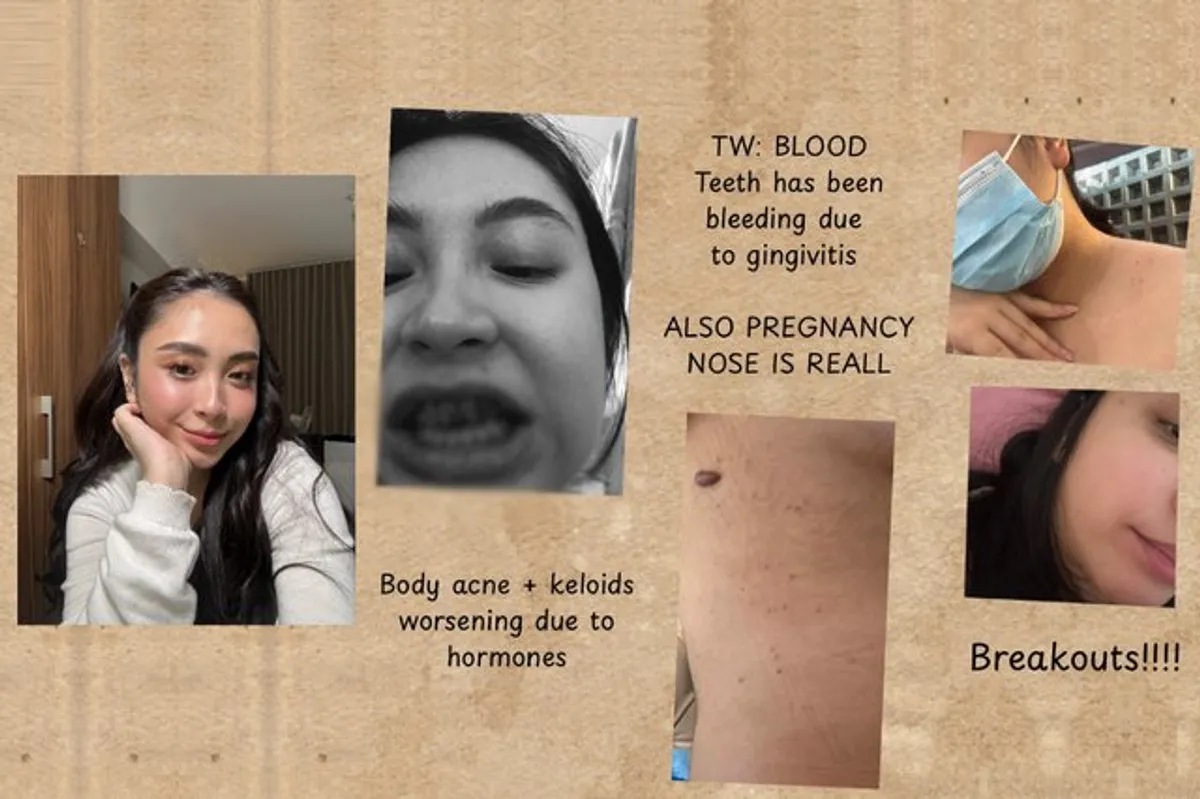 Bea Borres Opens Up About Pregnancy Struggles and Physical Changes in ...