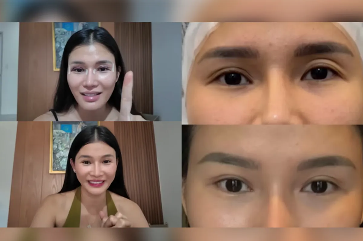 Jen Barangan reveals she underwent eyelid surgery | ABS-CBN Entertainment