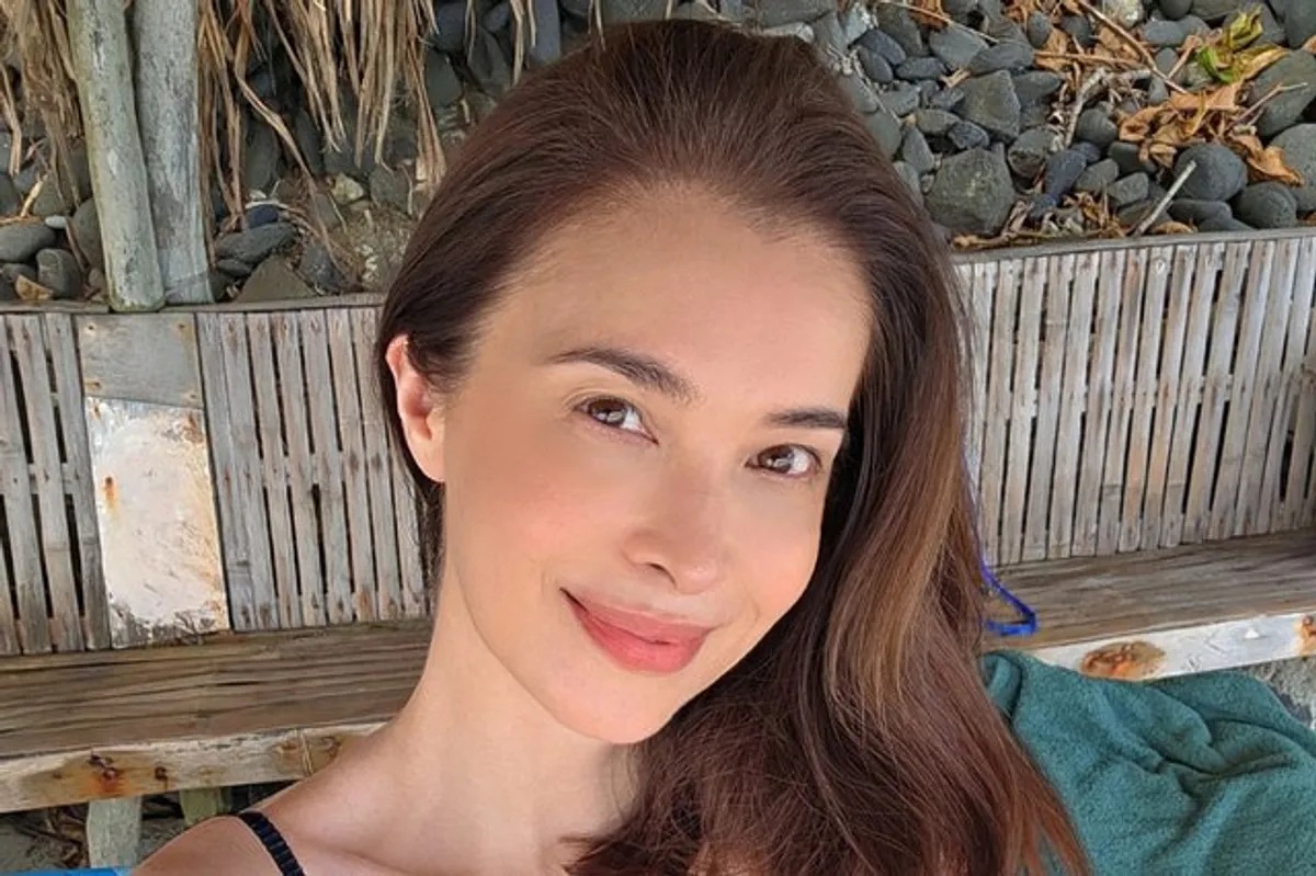 Sunshine Cruz reveals turning down projects due to her autoimmune ...