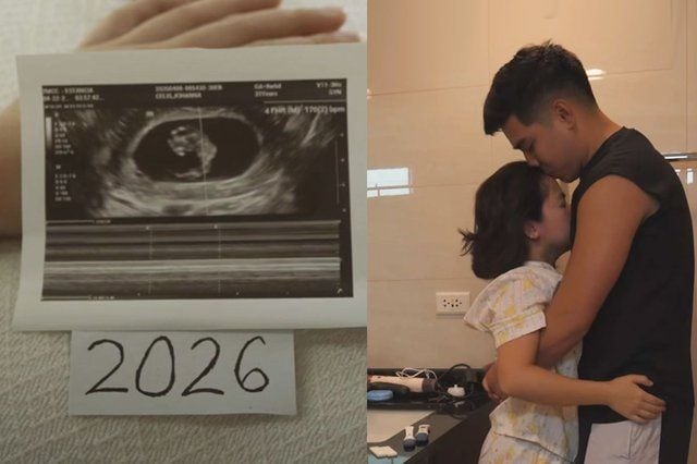 Kiray Celis is pregnant with first child | ABS-CBN Entertainment