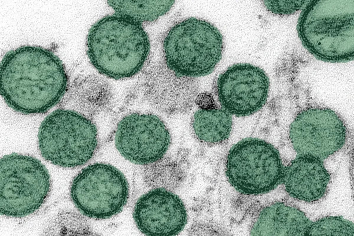DOH: Monitoring, preparations in place for hantavirus | ABS-CBN News